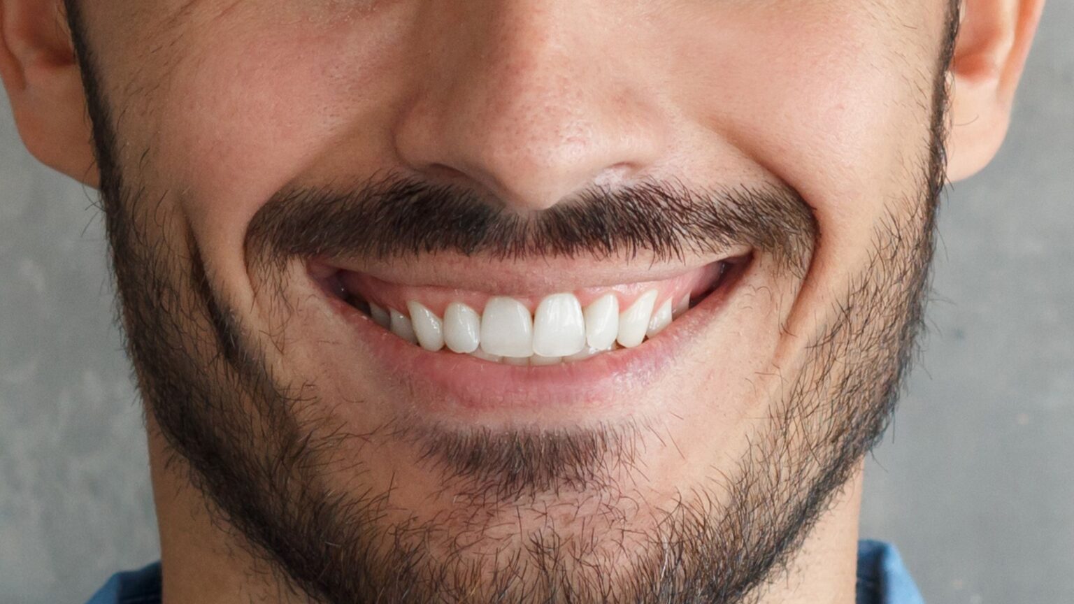 What Does a “Healthy Smile” Actually Look Like? | Smile of Ryde